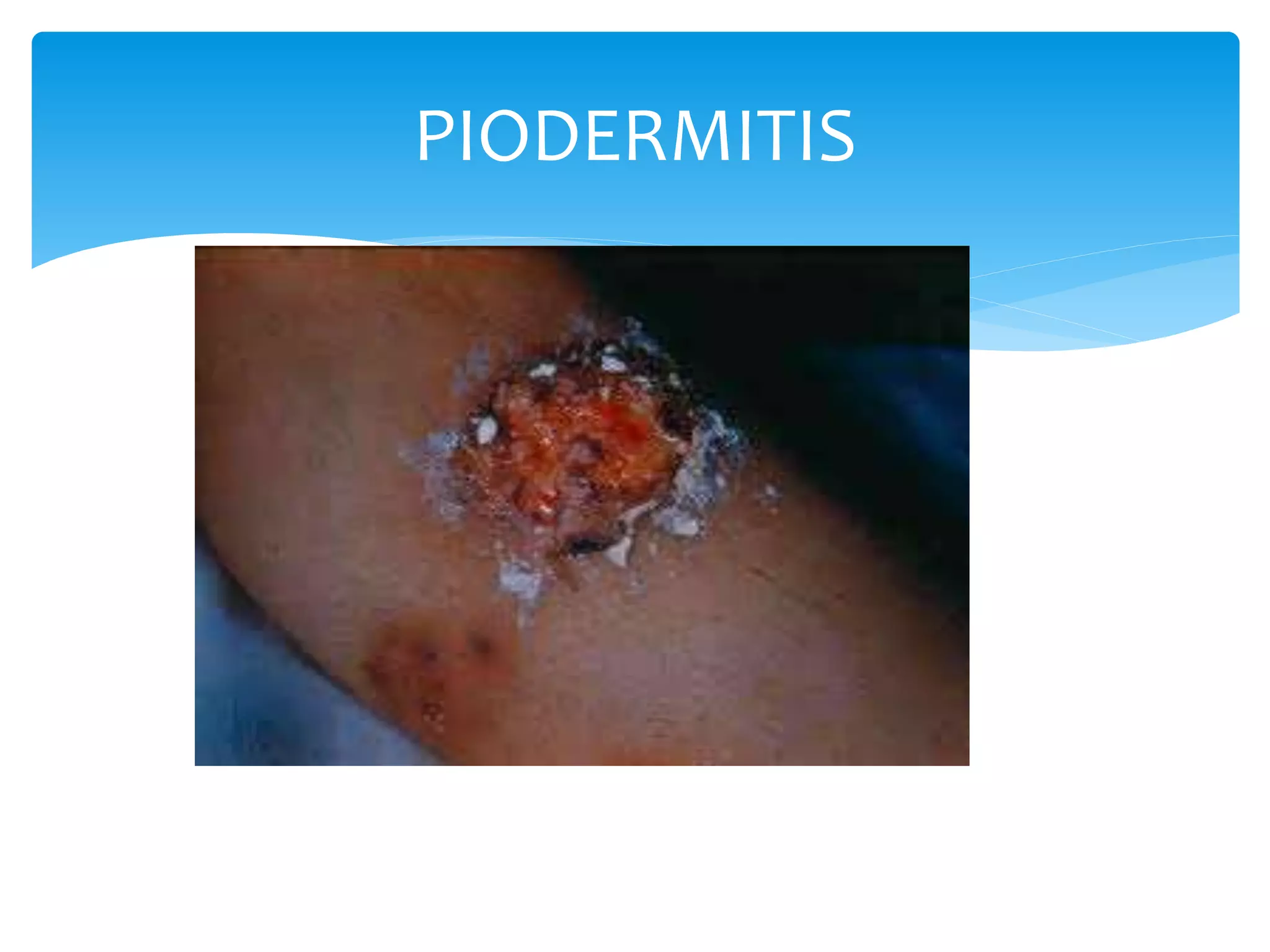 Dermatología piodermitis | PPTX