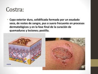 Diagrama De Costra De La Piel