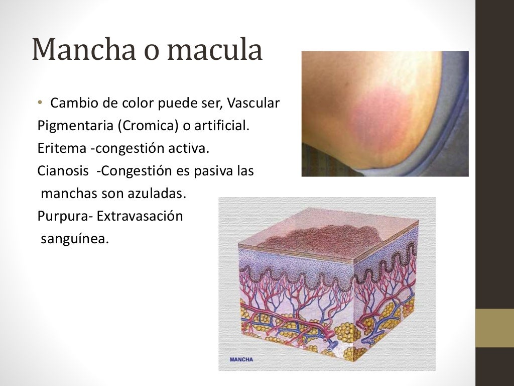 Dermatología (La Piel: Lesiones Elementales)