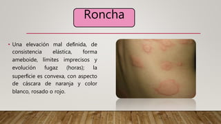 Dermatologia | PPTX