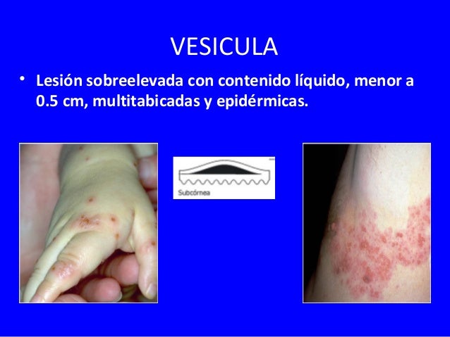 Dermatologia para Esteticistas