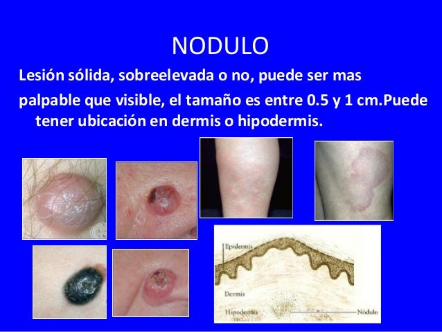 Dermatologia para Esteticistas