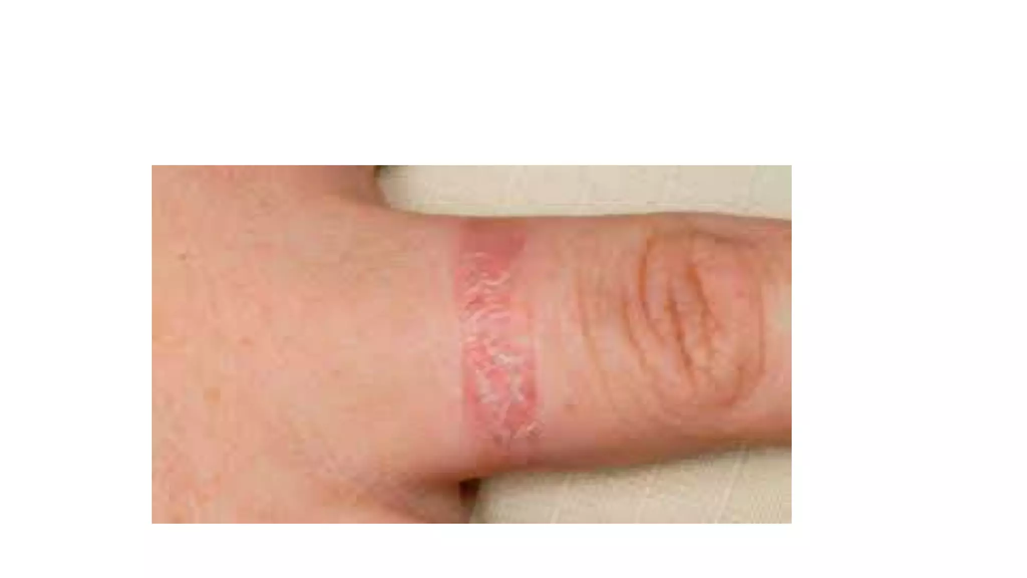 Dermatological emergencies.pptx