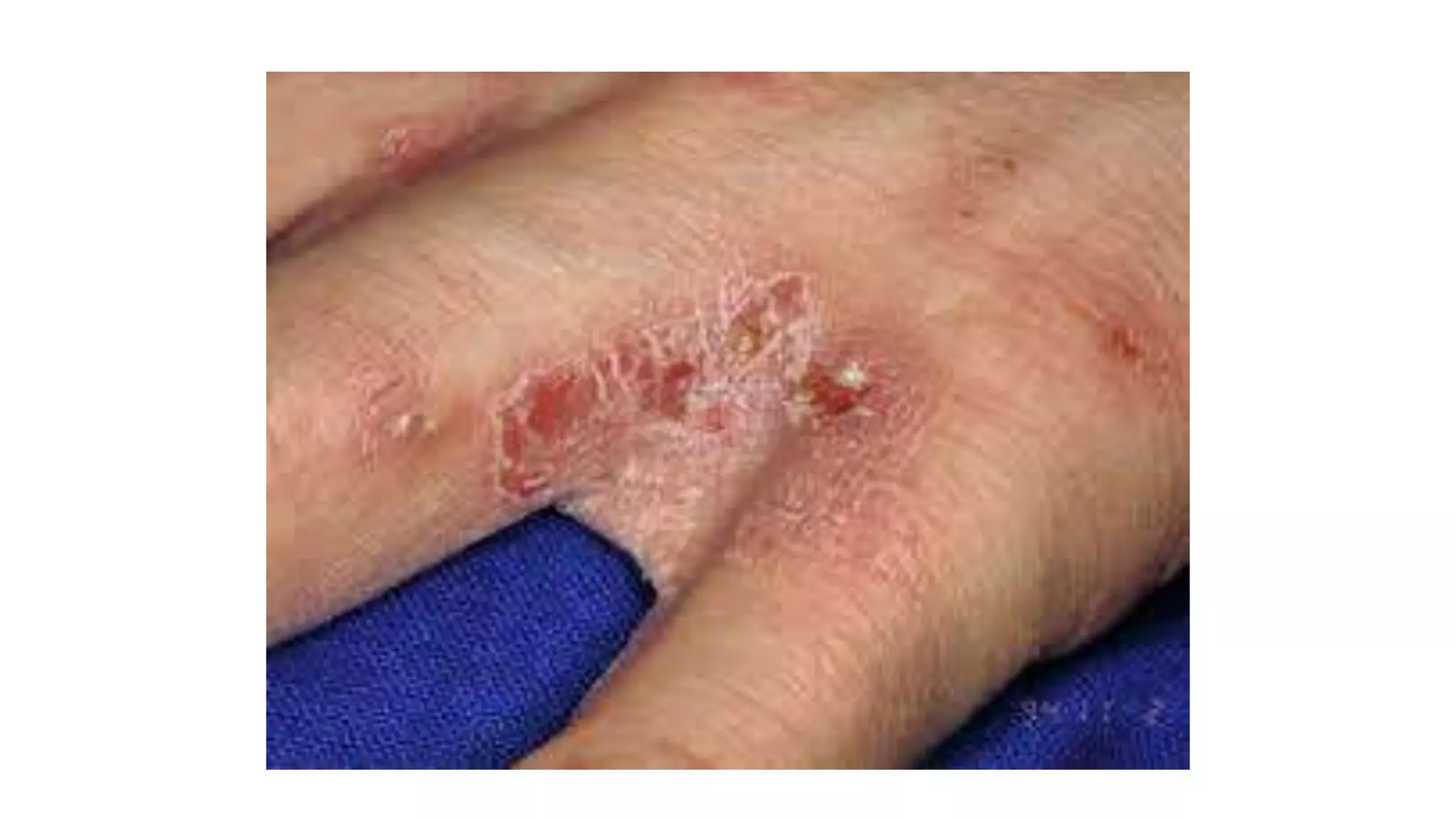 Dermatological emergencies.pptx