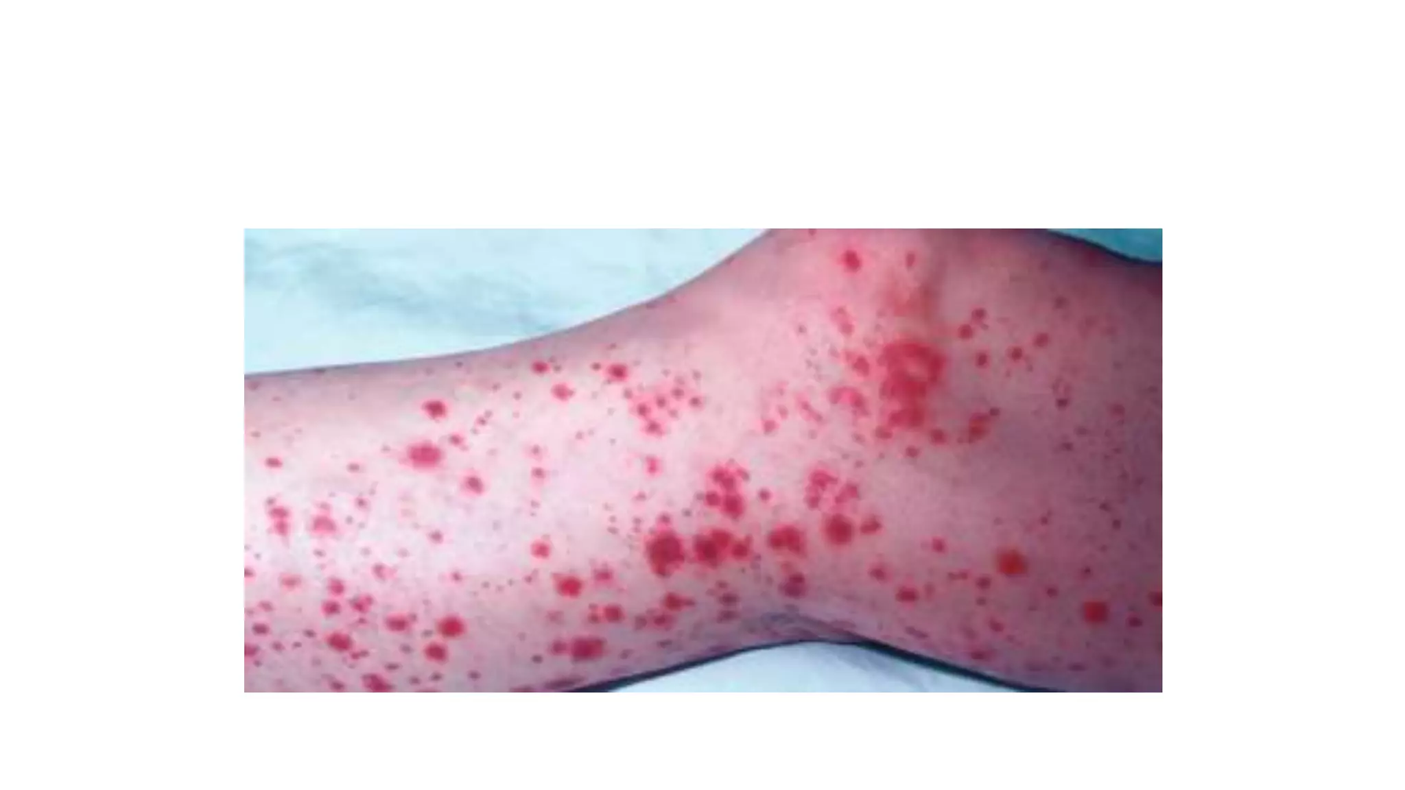 Dermatological emergencies.pptx