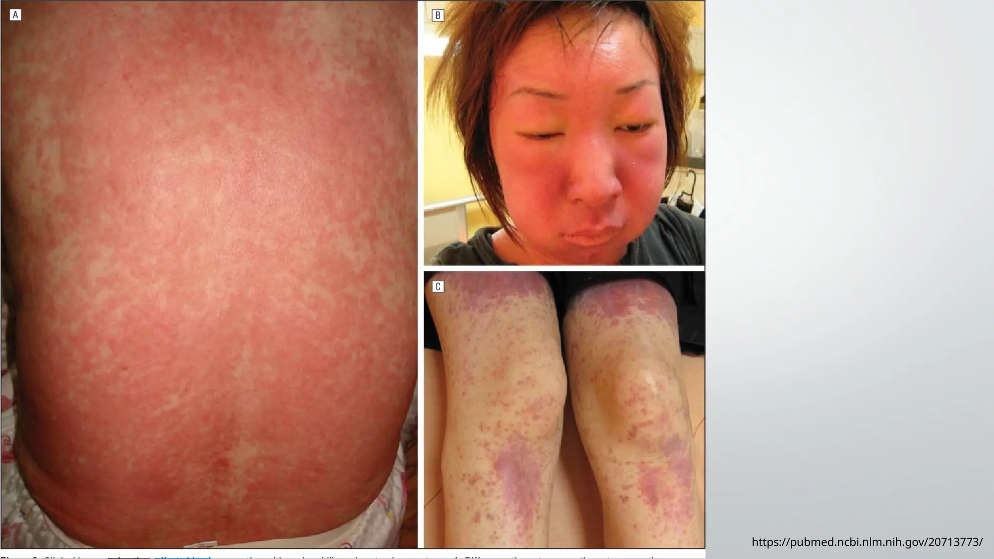 DERMATOLOGICAL EMERGENCIES for primary care.pptx