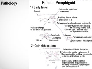 Dermatological emergency | PPT