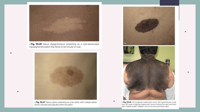 Dermatologic condition NB from NKP hospital | PPT