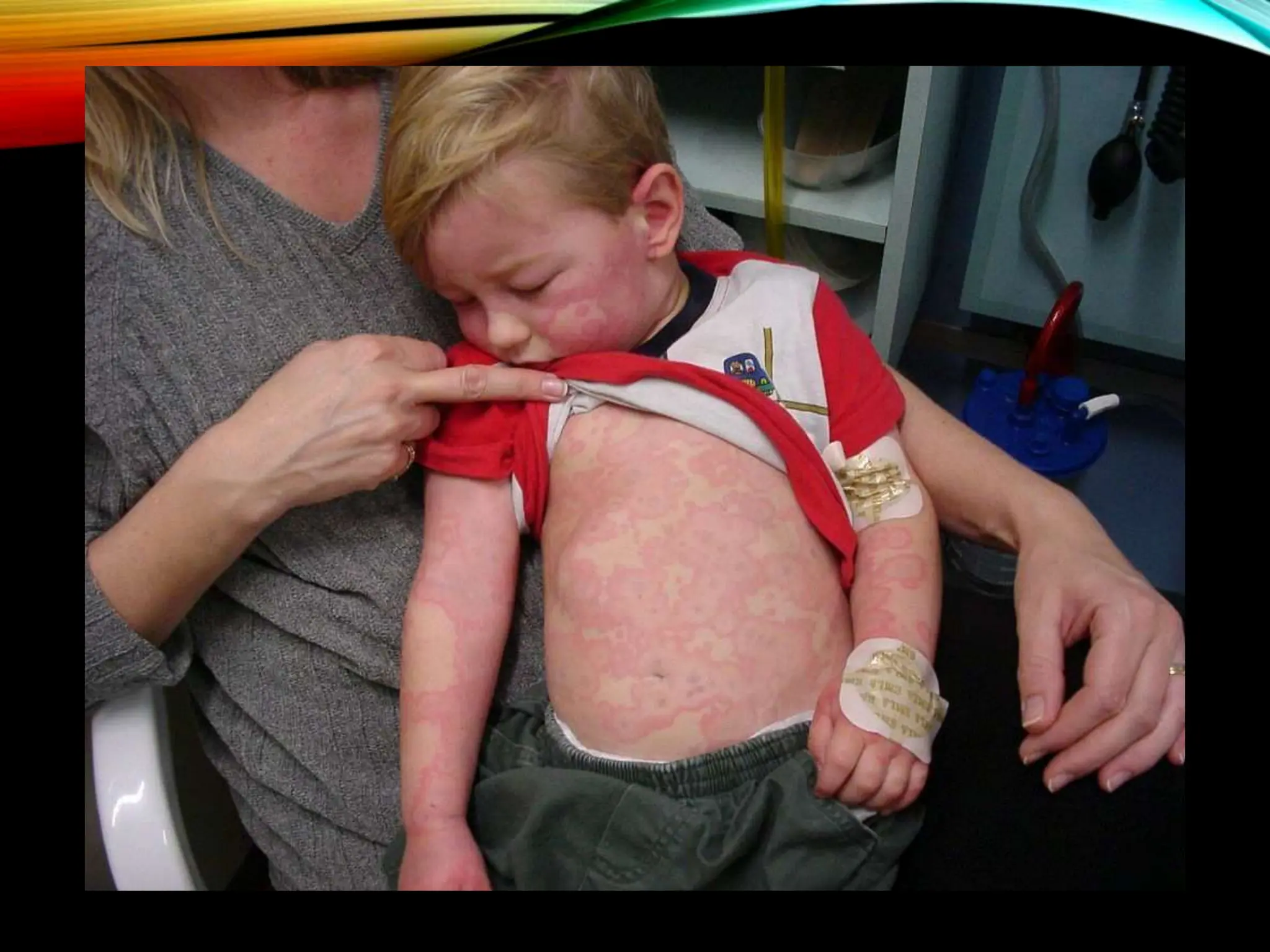 Dermatologic disorders commonly missed in the ED.pptx