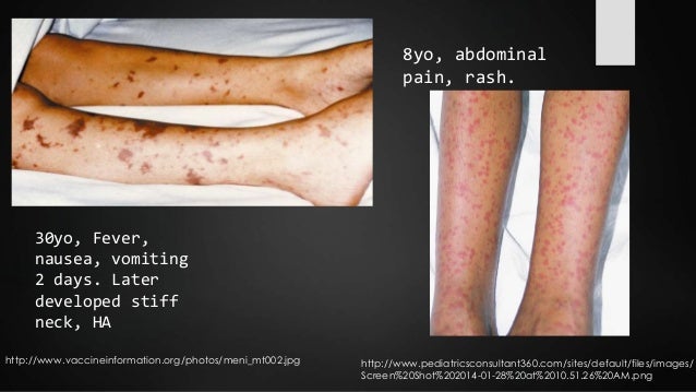 Dermatologic Emergencies - Dr. Siciliano