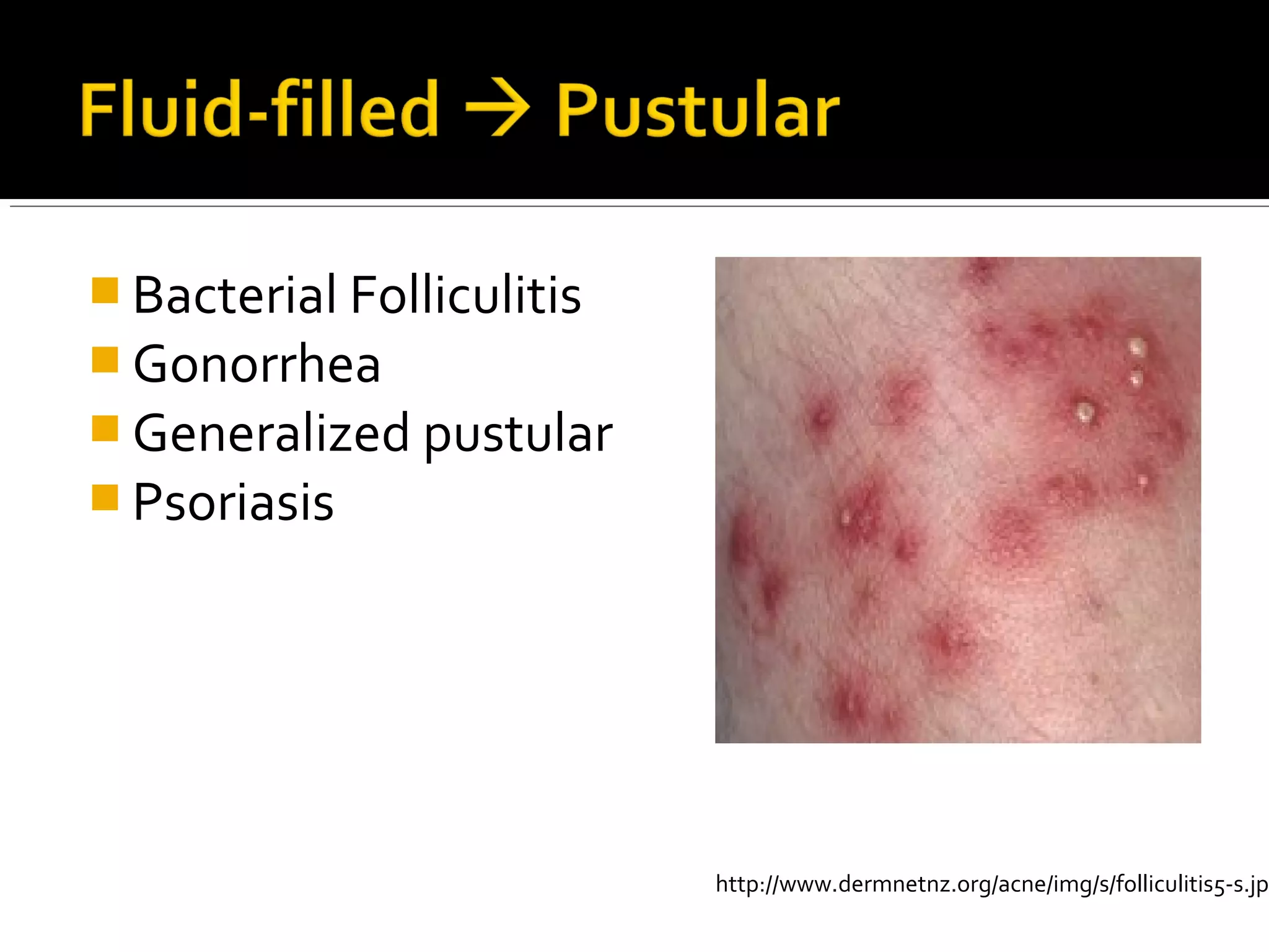 Dermatologic emergencies | PPT