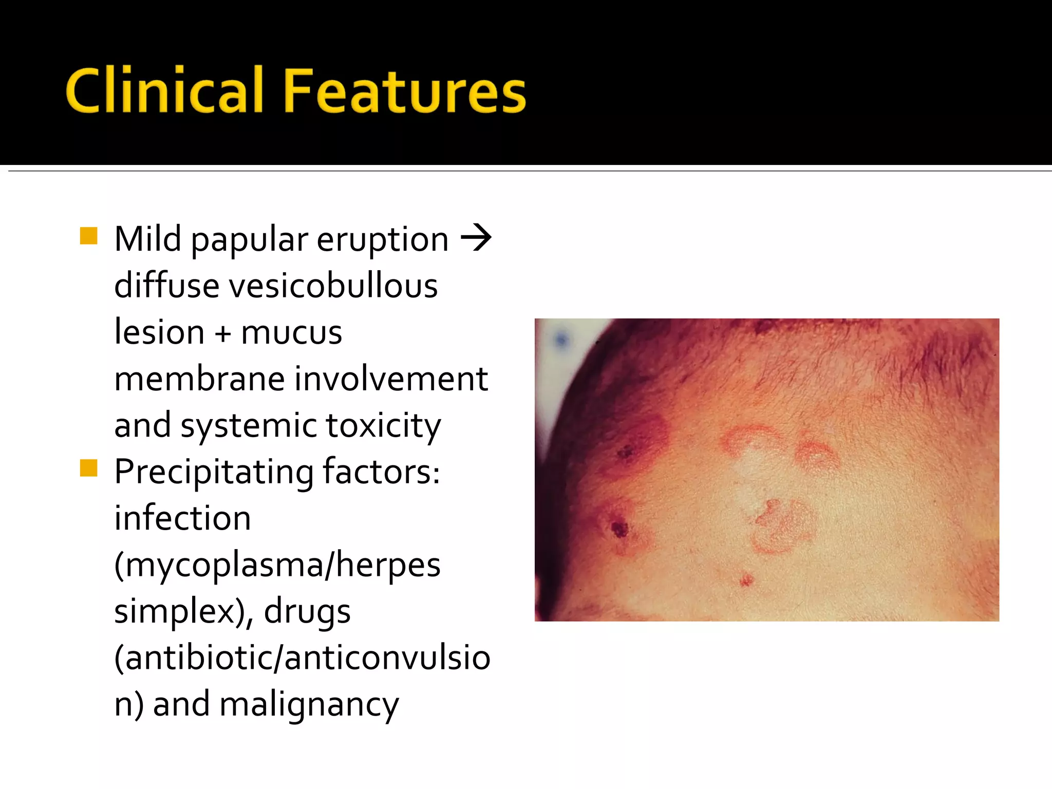 Dermatologic emergencies | PPT