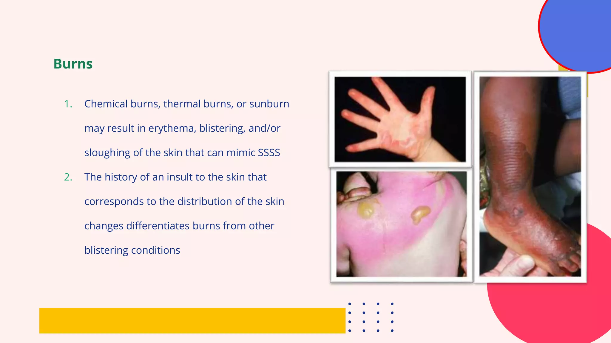 Dermatologic Emergencies in Children | PPTX