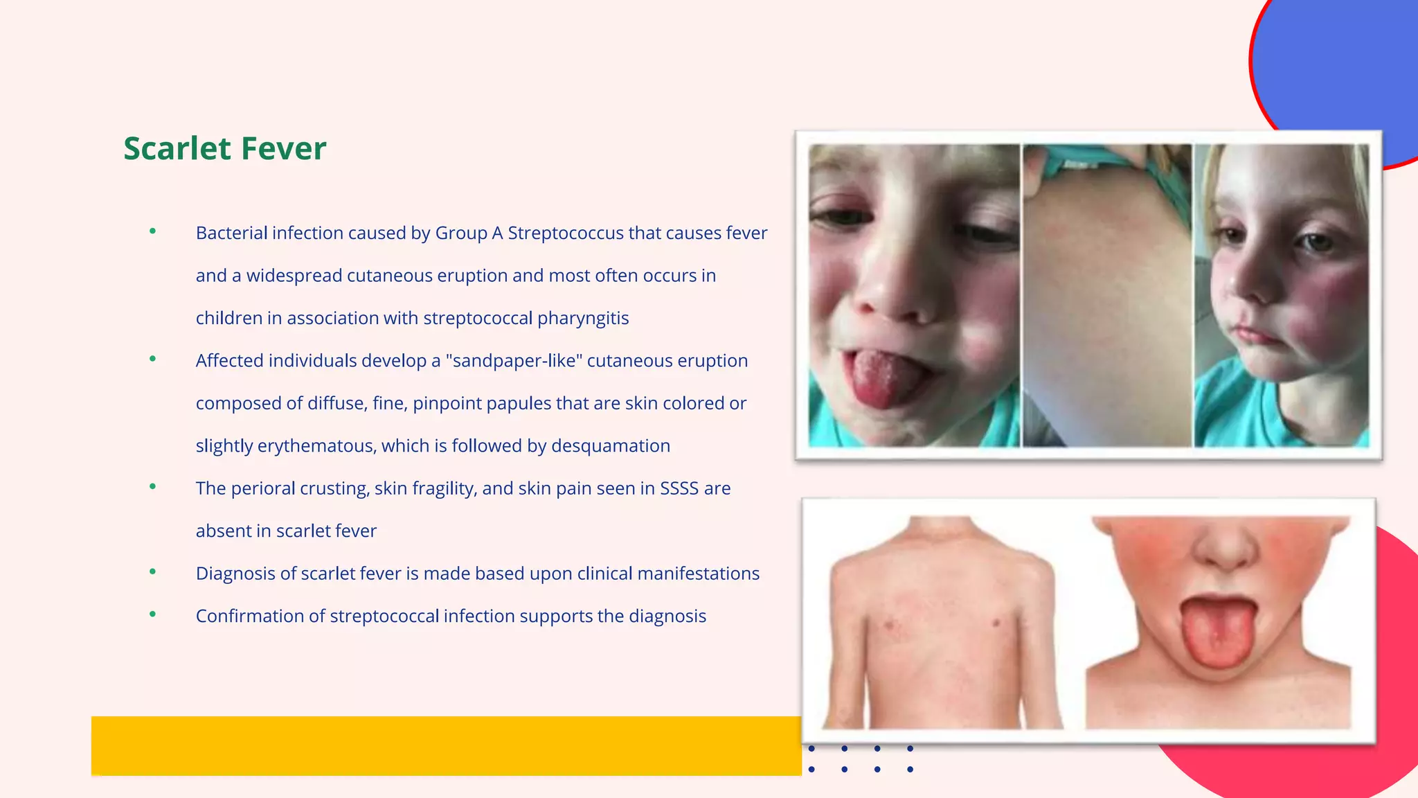 Dermatologic Emergencies in Children | PPTX