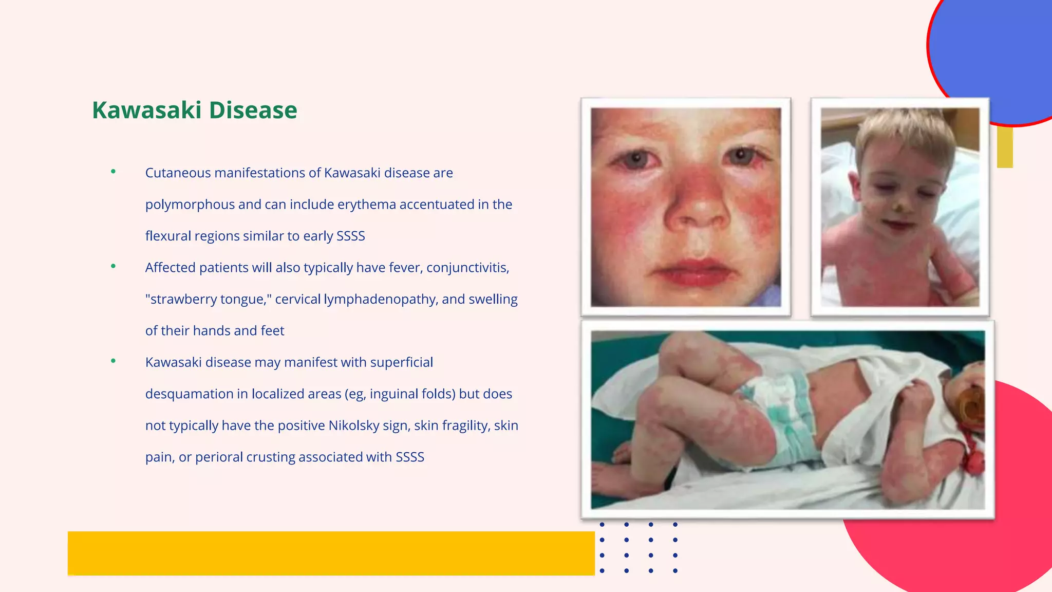 Dermatologic Emergencies in Children | PPTX