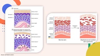 Dermatologic Emergencies in Children | PPTX