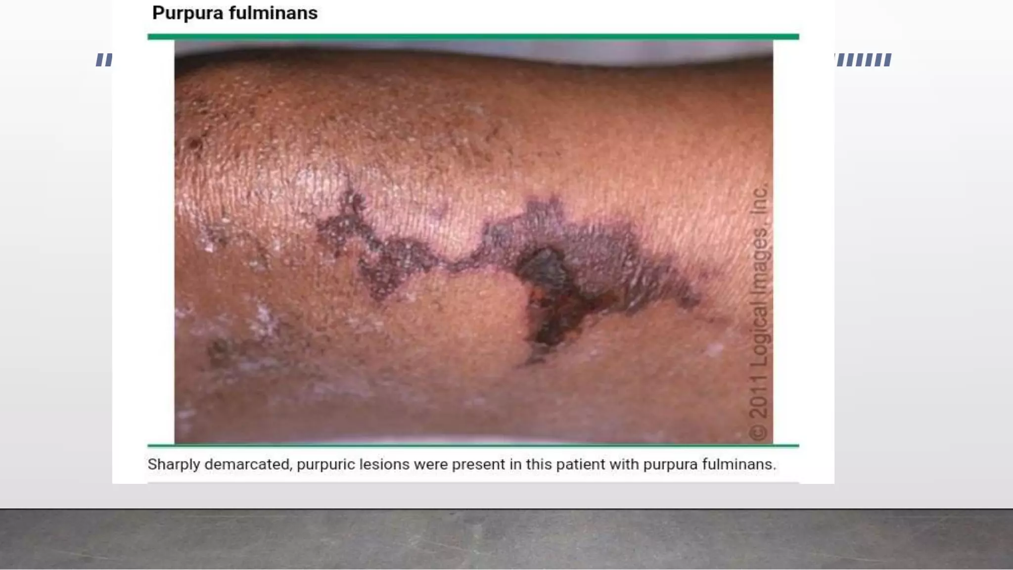 Dermatologic manifestations of renal diseases | PPTX