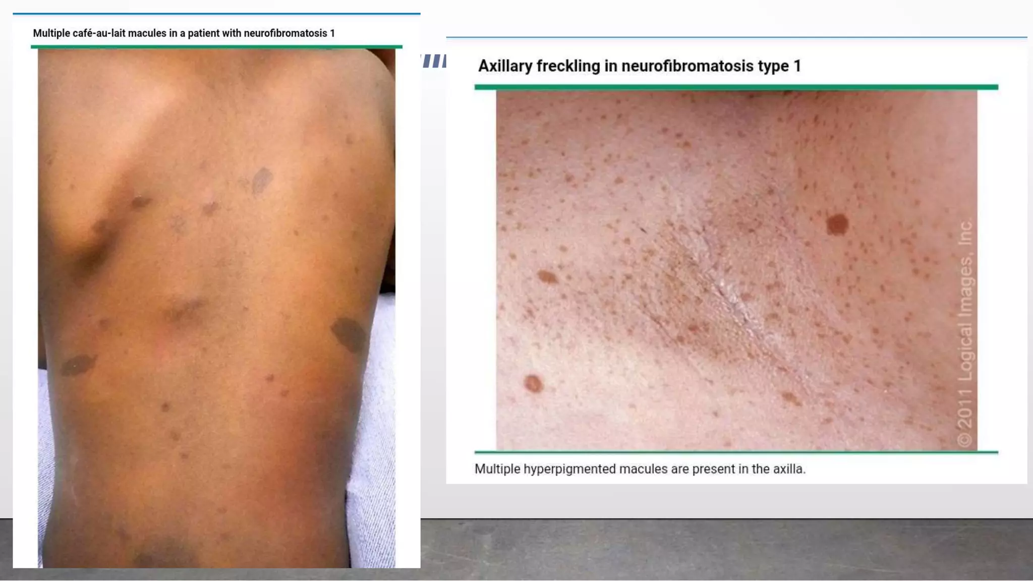 Dermatologic manifestations of renal diseases | PPTX