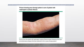 Dermatologic manifestations of renal diseases | PPTX