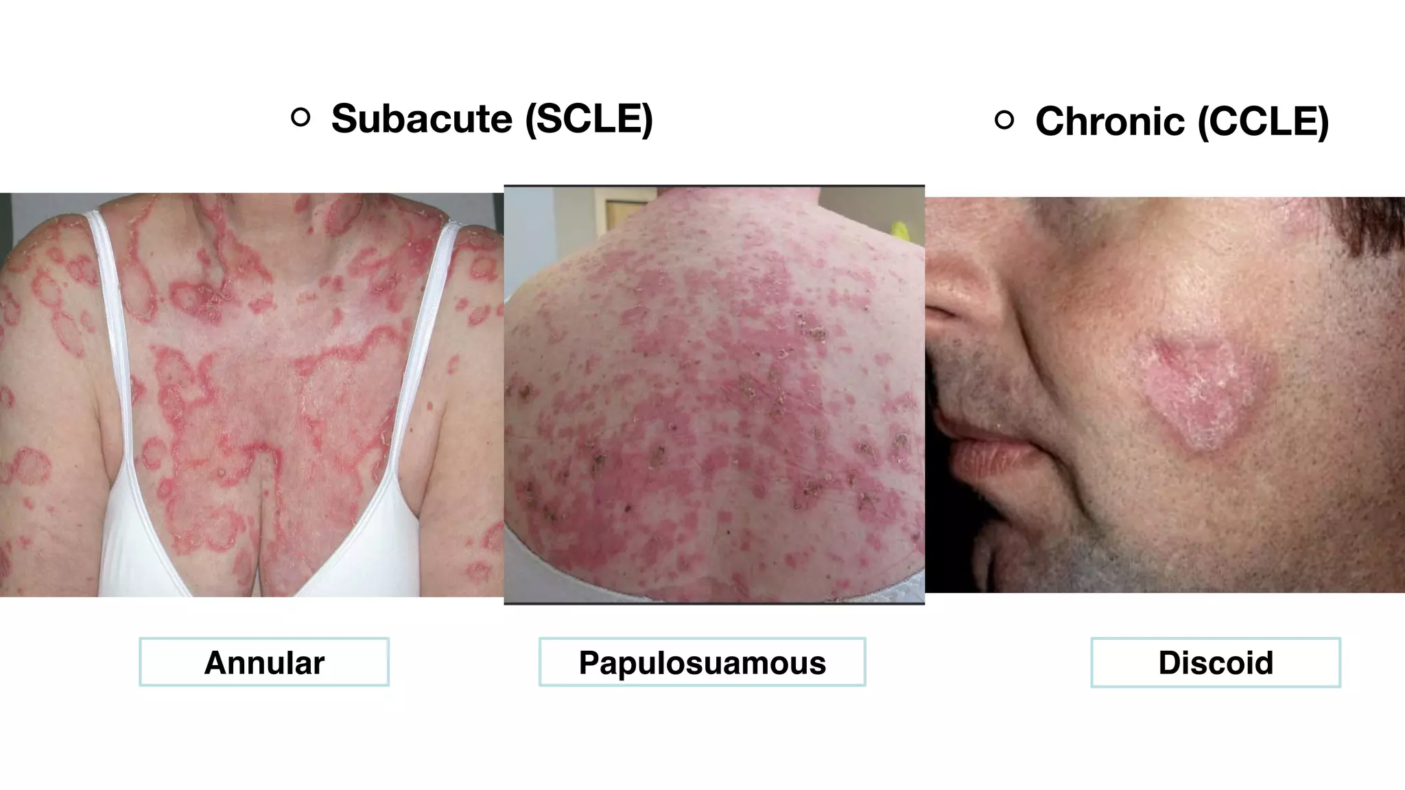 Dermatologic Manifestations of Systemic Diseases.pdf