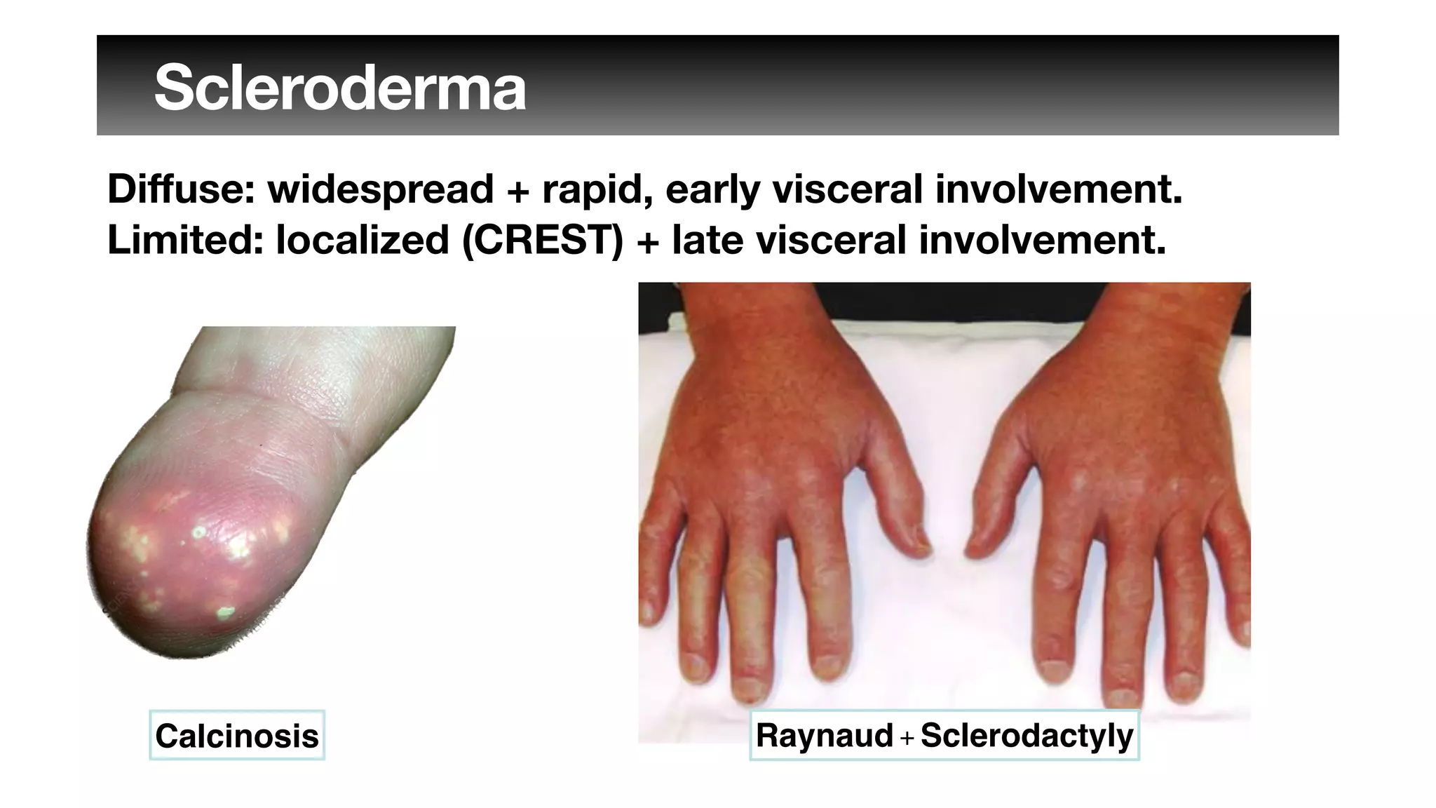 Dermatologic Manifestations of Systemic Diseases.pdf