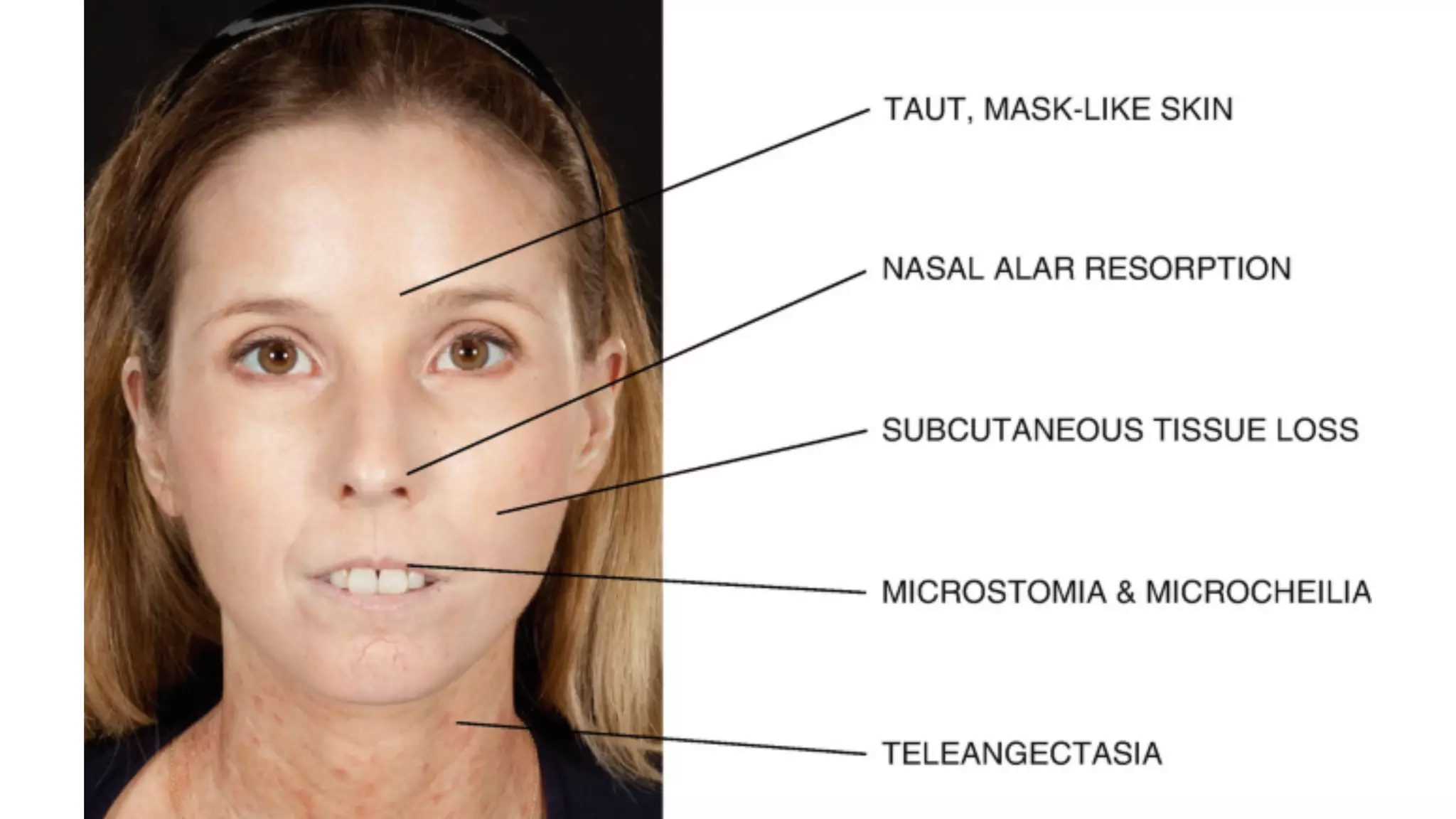 Dermatologic Manifestations of Systemic Diseases.pdf