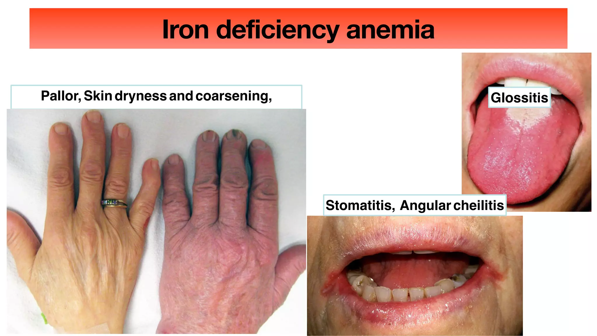 Dermatologic Manifestations of Systemic Diseases.pdf