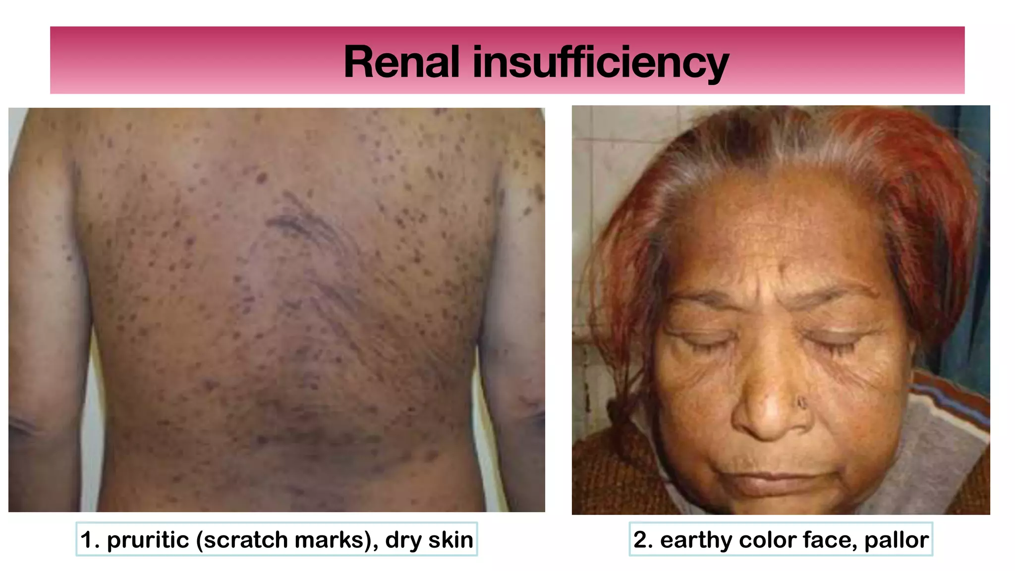 Dermatologic Manifestations of Systemic Diseases.pdf