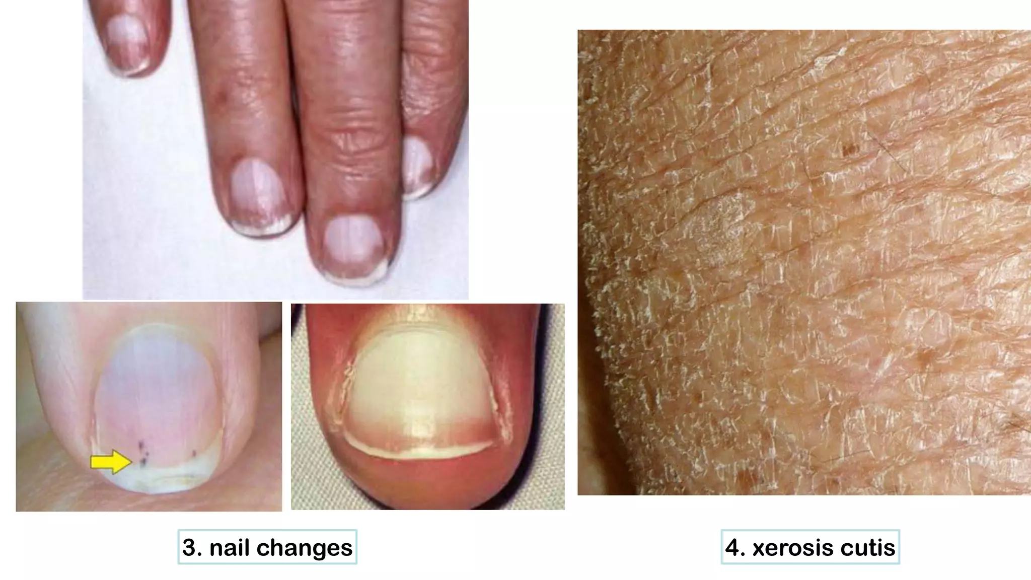 Dermatologic Manifestations of Systemic Diseases.pdf