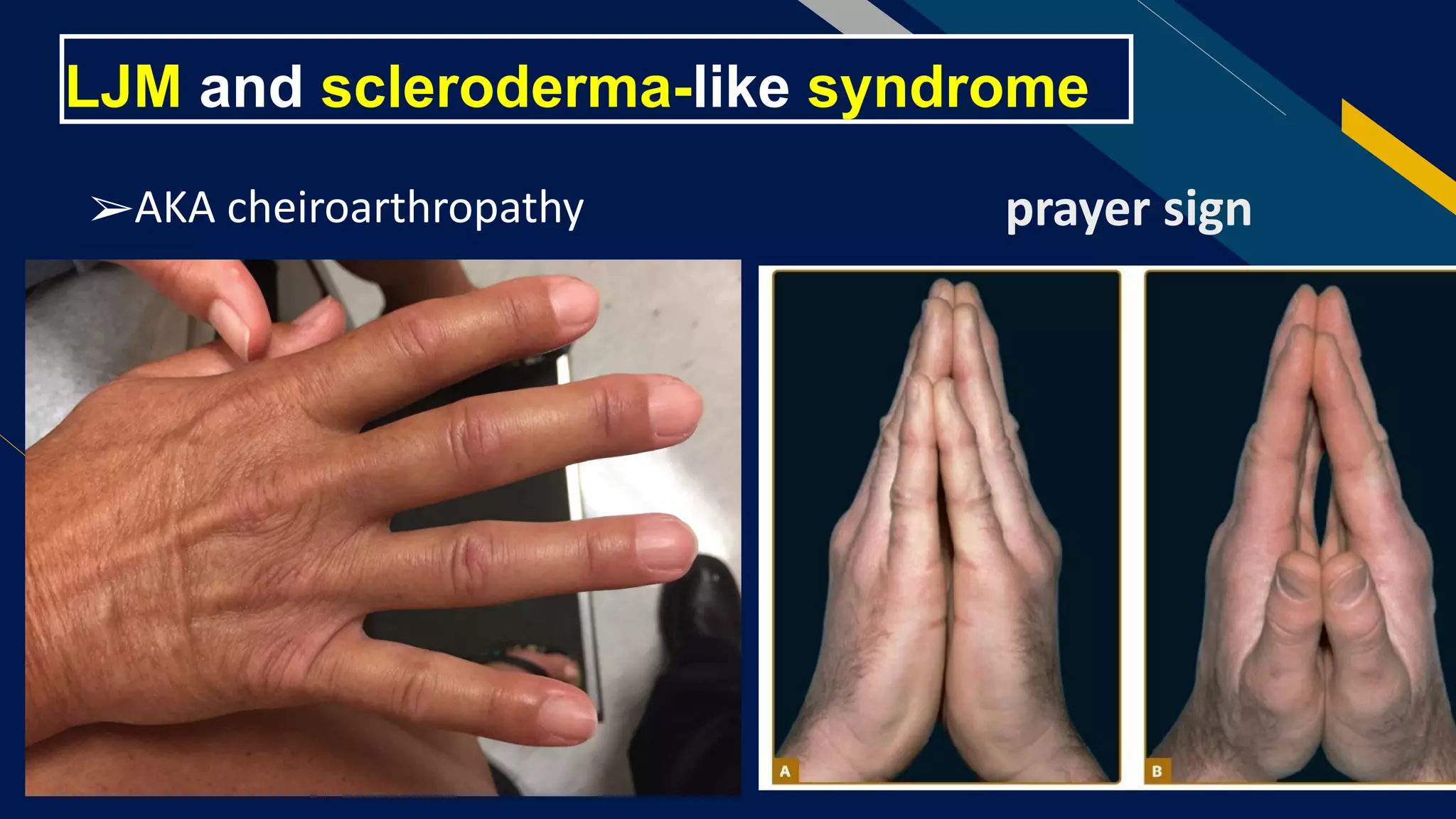 Dermatologic Manifestations of Systemic Diseases.pdf
