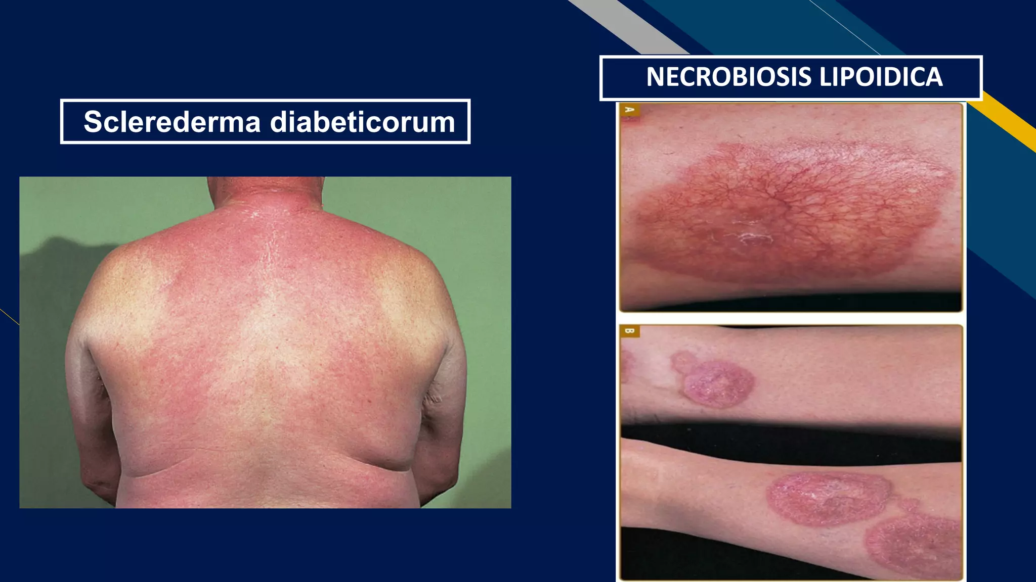 Dermatologic Manifestations of Systemic Diseases.pdf