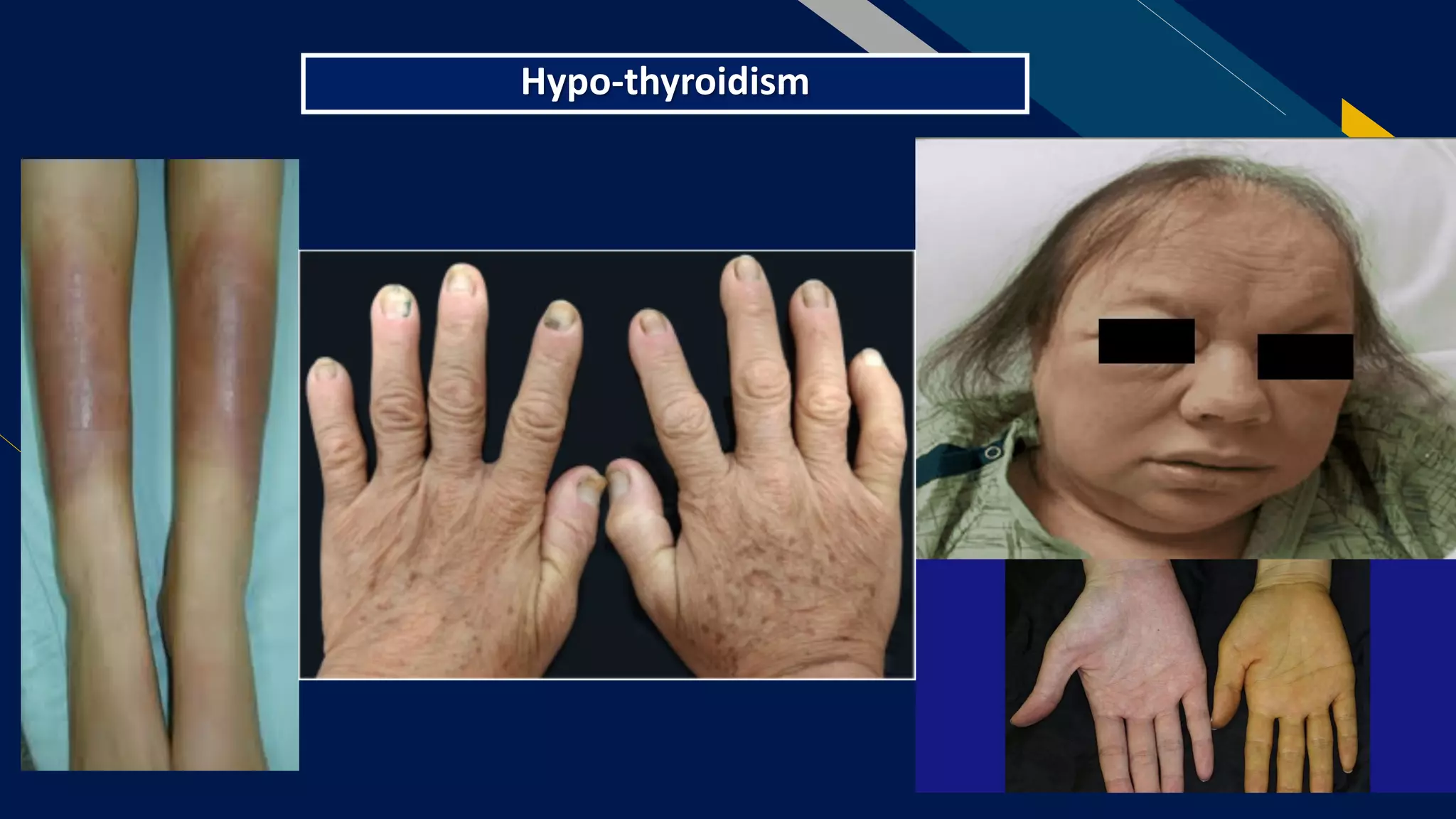 Dermatologic Manifestations of Systemic Diseases.pdf