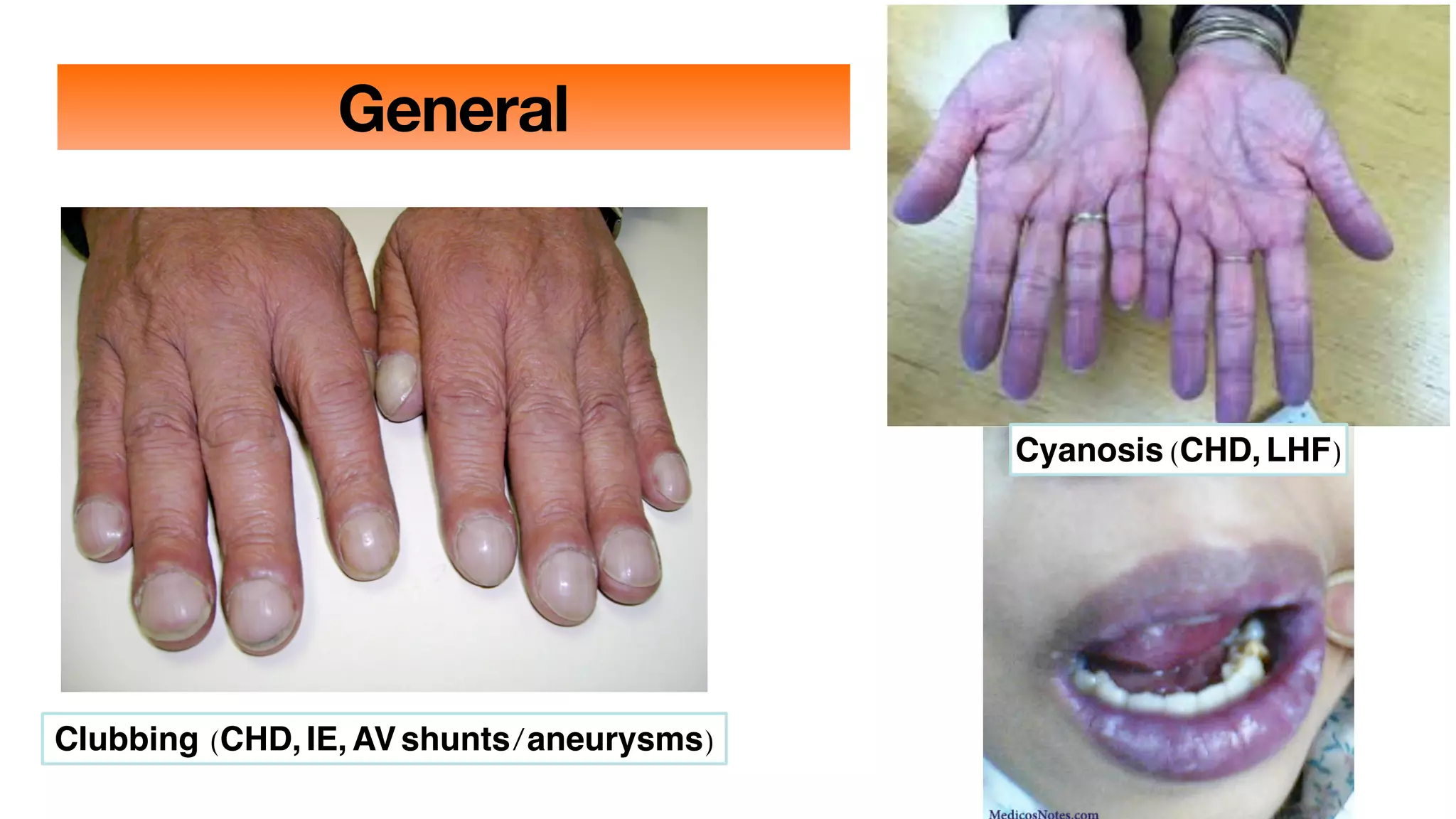 Dermatologic Manifestations of Systemic Diseases.pdf