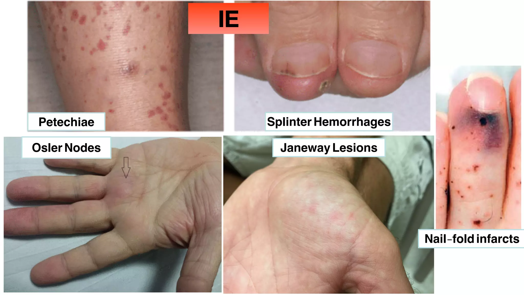 Dermatologic Manifestations of Systemic Diseases.pdf