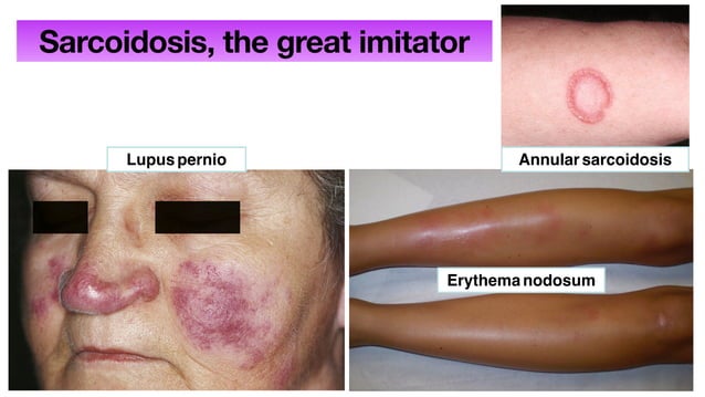 Dermatologic Manifestations of Systemic Diseases.pdf