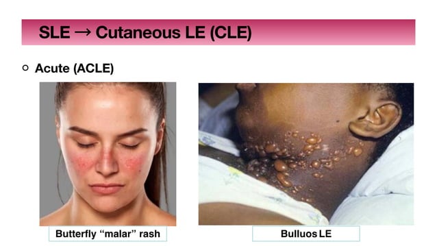 Dermatologic Manifestations of Systemic Diseases.pdf