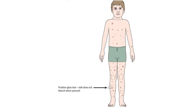Dermatologic Manifestations of Systemic Diseases.pdf