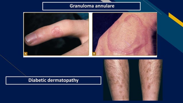 Dermatologic Manifestations of Systemic Diseases.pdf
