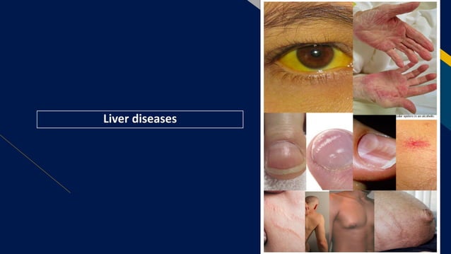 Dermatologic Manifestations of Systemic Diseases.pdf