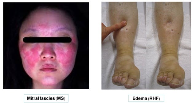 Dermatologic Manifestations of Systemic Diseases.pdf