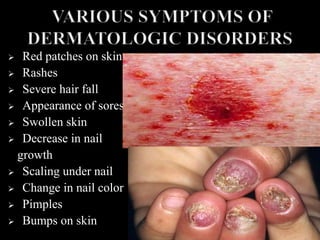 Austin Journal of Dermatology | PPTX