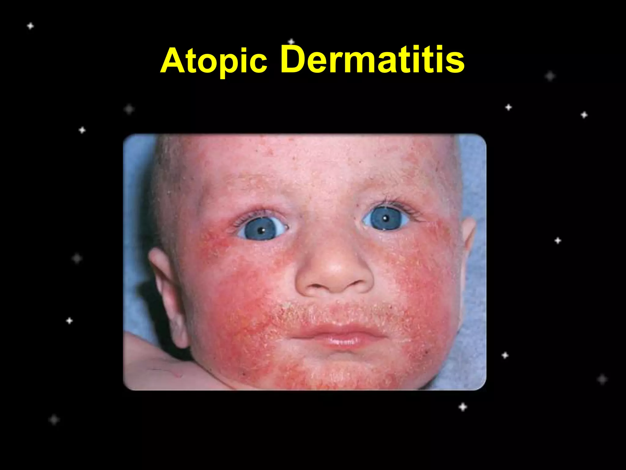 Dermatology - Common Skin Diseases | PPTX | Skin and Dermatology ...
