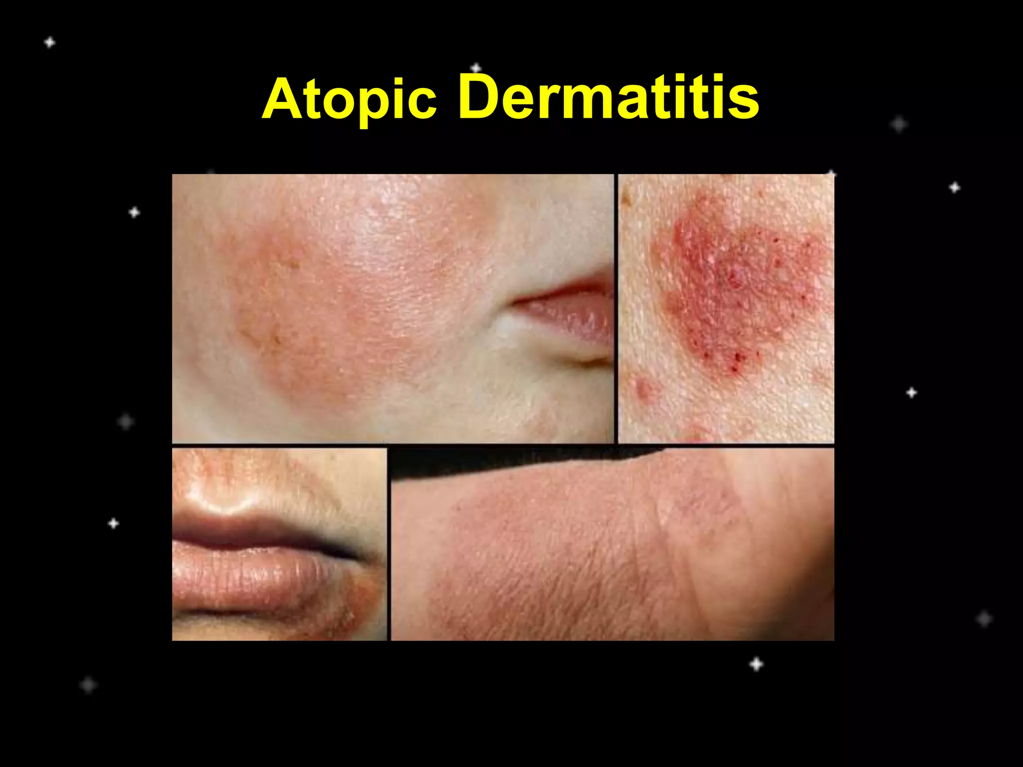 Dermatology - Common Skin Diseases | PPTX | Skin and Dermatology ...