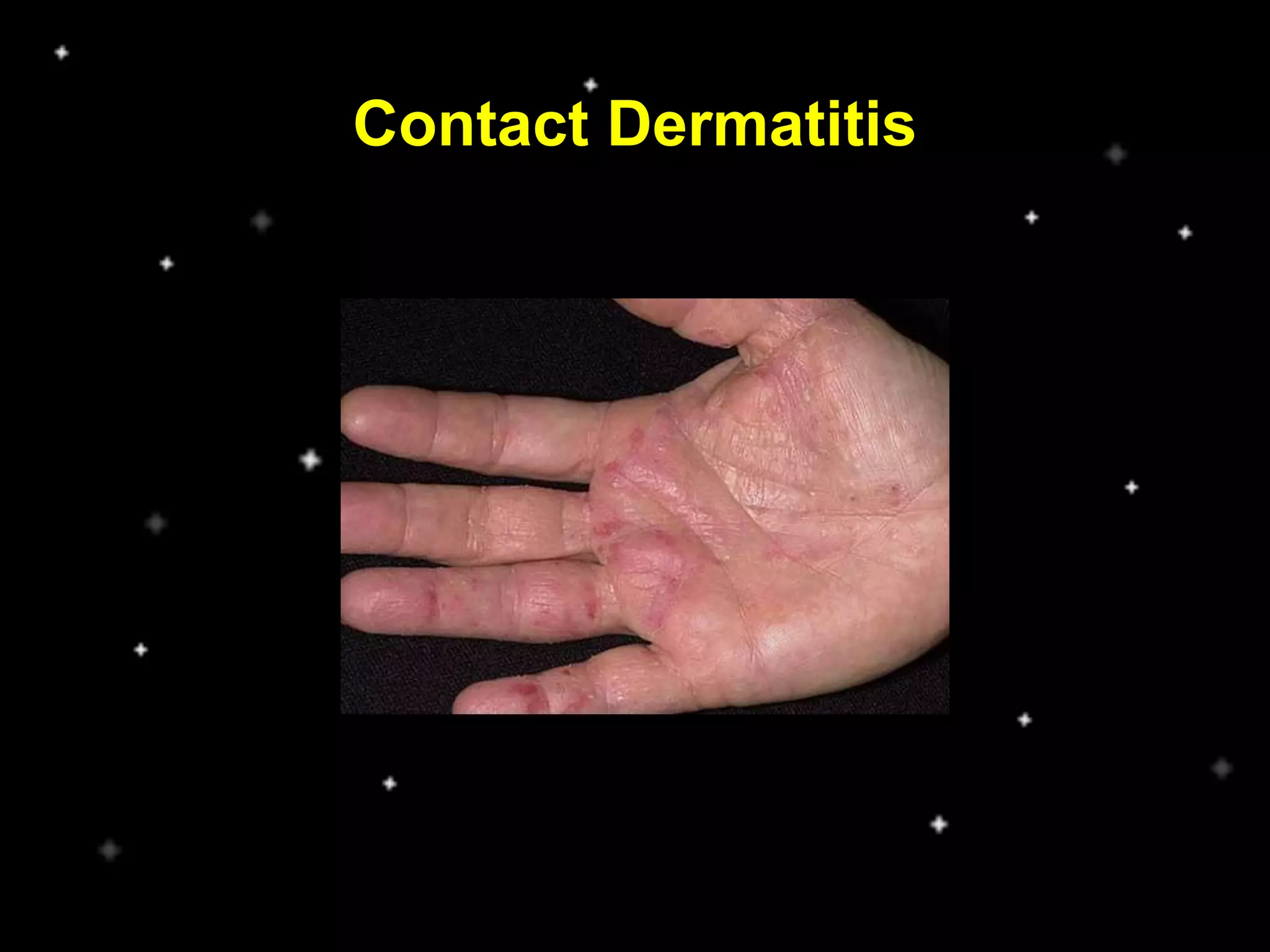 Dermatology - Common Skin Diseases | PPTX