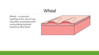 Introduction to Dermatology | PDF