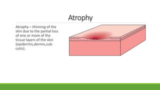 Introduction to Dermatology | PDF | Skin and Dermatology | Diseases and ...