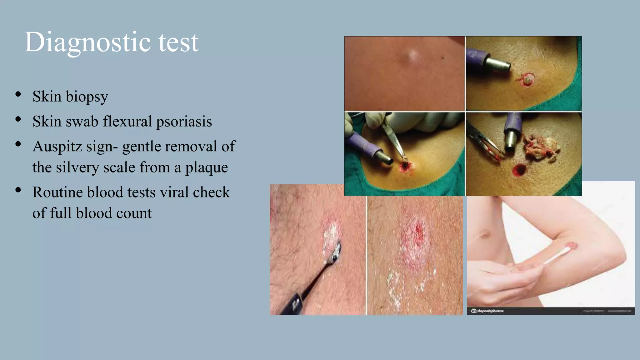 dermatology - Psoriasis | PPTX | Skin and Dermatology | Diseases and ...