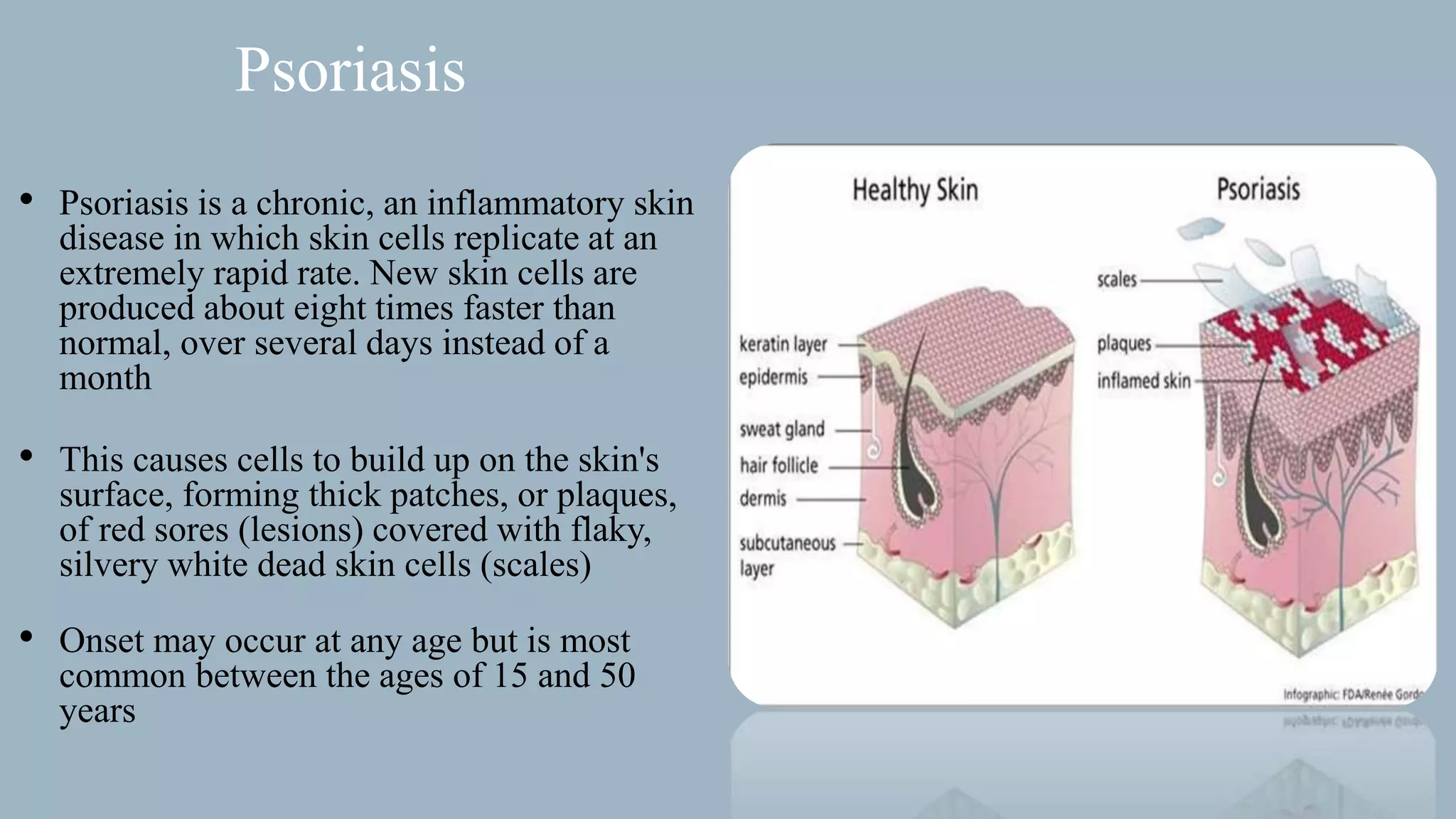 dermatology - Psoriasis | PPTX | Skin and Dermatology | Diseases and ...
