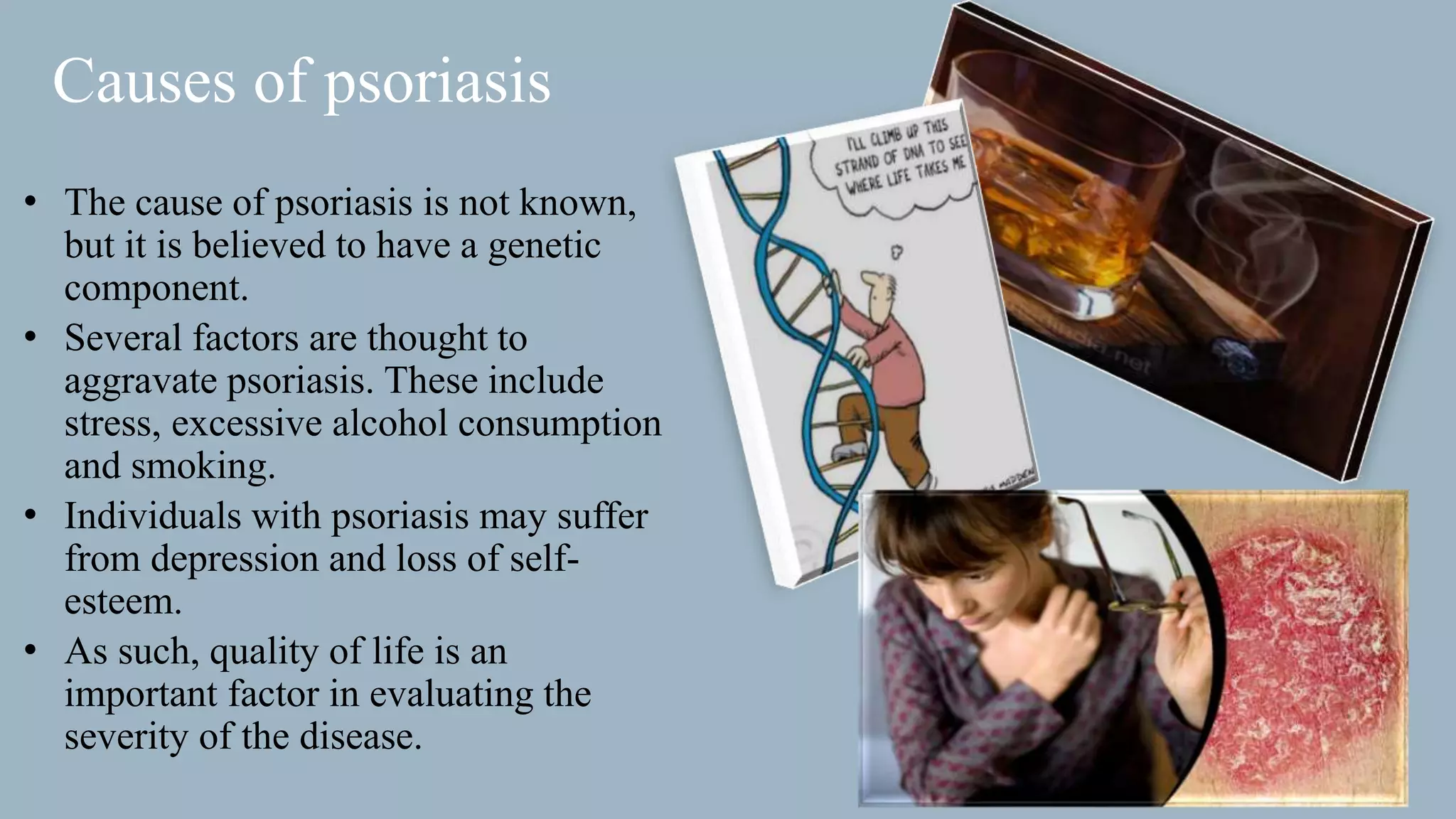 dermatology - Psoriasis | PPTX | Skin and Dermatology | Diseases and ...