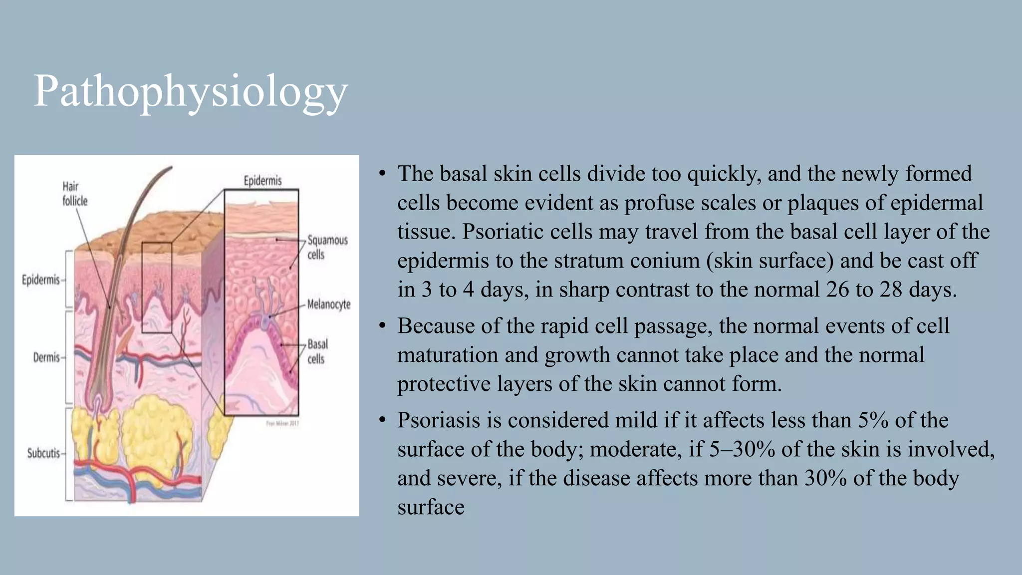 dermatology - Psoriasis | PPTX | Skin and Dermatology | Diseases and ...
